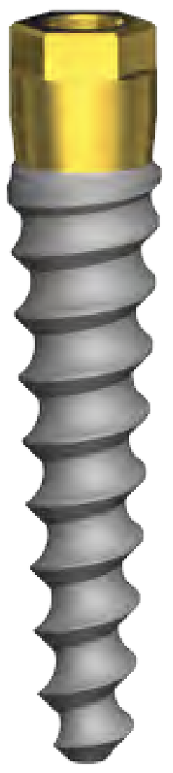 Alpha Bio Tec Spiral (SPI) Dental Implant | SpotImplant