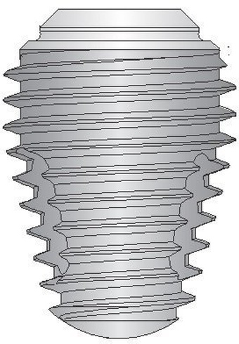 Southern Implants Promax Dental Implant | SpotImplant