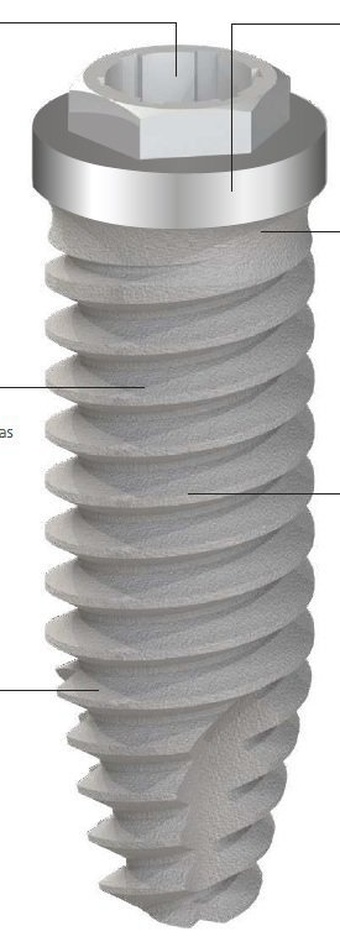 Inspiral Implantes dentales | SpotImplant