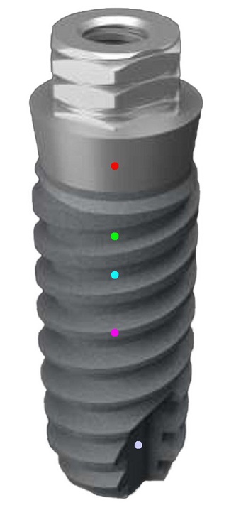 SpotImplant | Such- und Identifikationsmaschine für Zahnimplantate