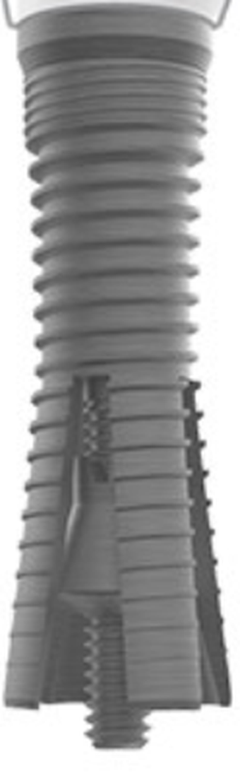 Dental Implants With a Flared Apex | SpotImplant