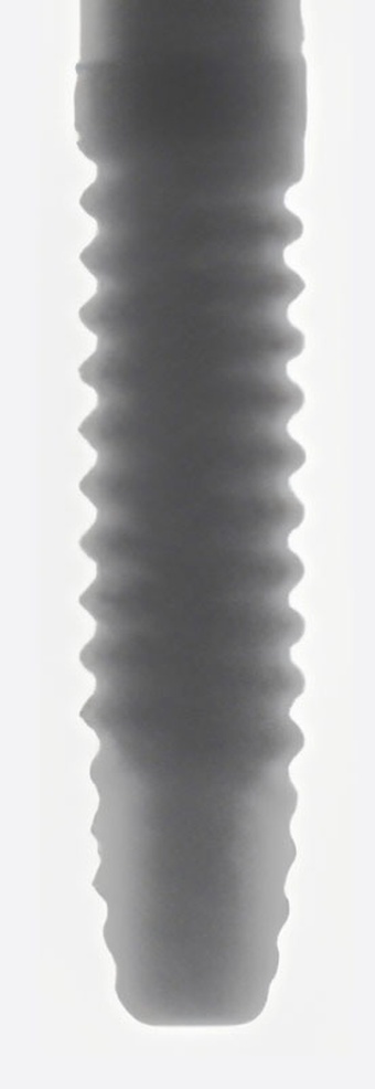 BioHorizons Tapered Pro Conical Dental Implant | SpotImplant