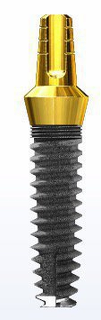 OCO Biomedical Engage Plus Implante dentário | SpotImplant