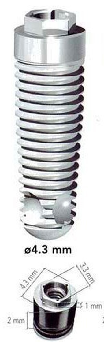 Intra-Lock System International Implantes dentários | SpotImplant