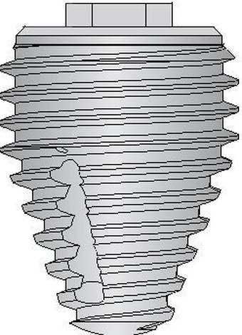Southern Implants External Hex (Tapered Narrow) Dental Implant | SpotImplant