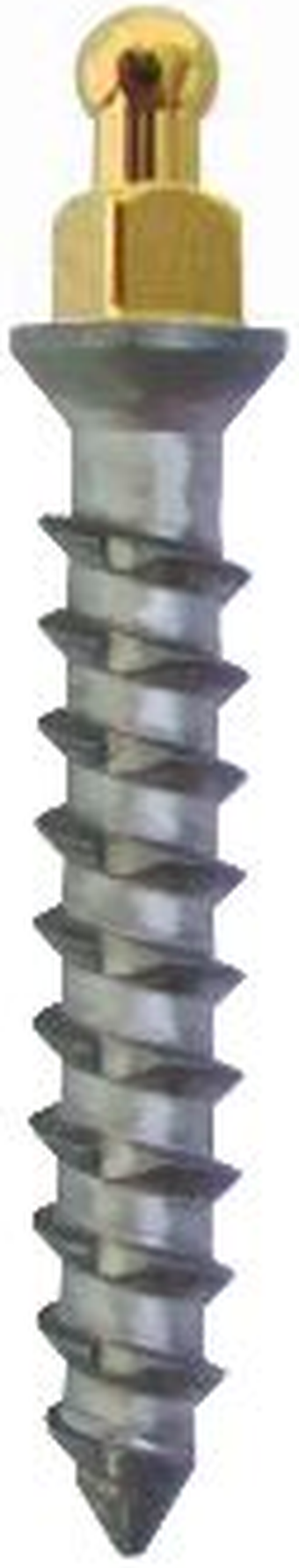 Dental implants With Buttress Threads | SpotImplant