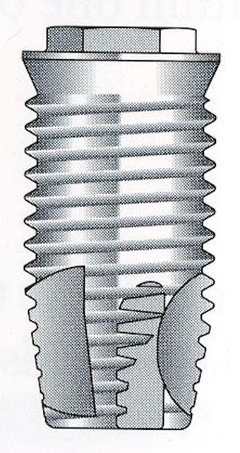 Nobel Biocare Branemark System MK III TiUnite Dental Implant | SpotImplant