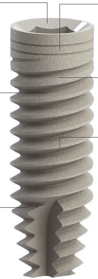 Inspiral MBC Implante dental | SpotImplant