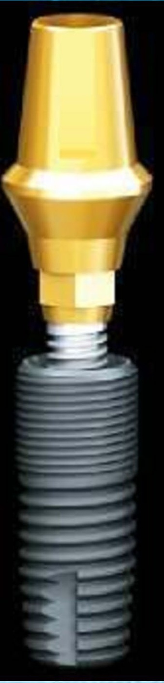 Megagen AnyOne Internal Zahnimplantat | SpotImplant