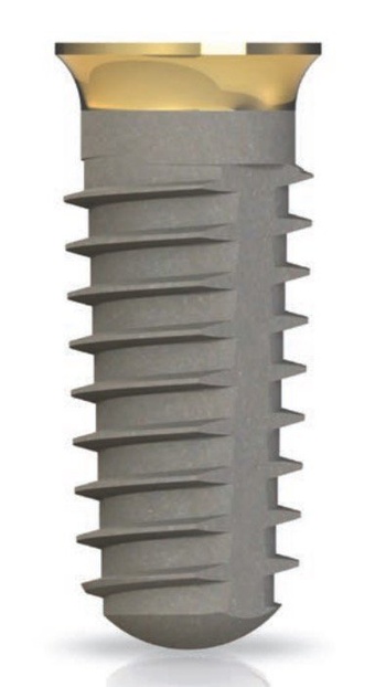 IDI Dental Implants dentaires | SpotImplant