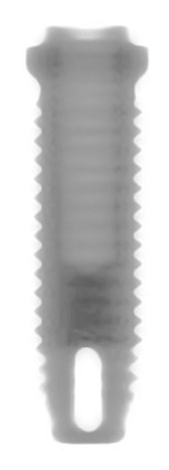 Nobel Biocare Branemark System MK IV Dental Implant | SpotImplant