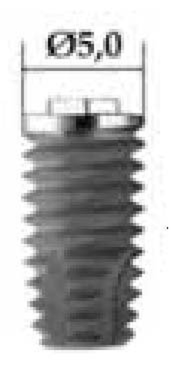 Microtech Minivent plus Dental Implant | SpotImplant