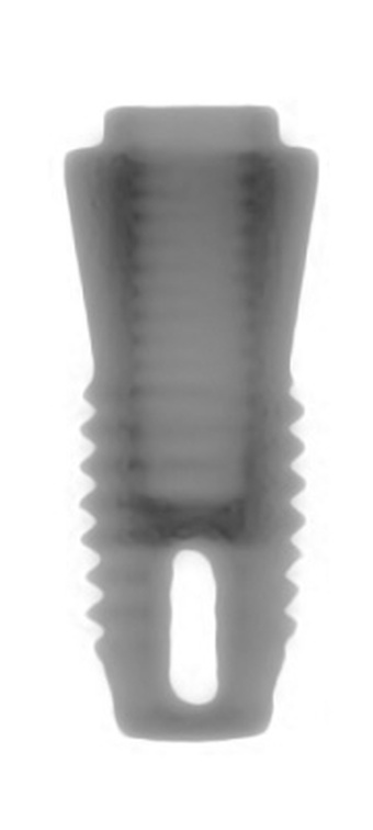 Nobel Biocare Branemark System MK III TiUnite Dental Implant | SpotImplant