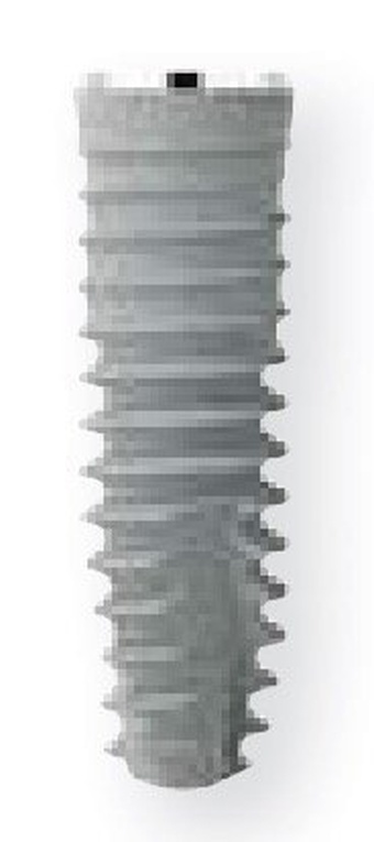 Dentsply Sirona XiVE S (Friadent) Zahnimplantat | SpotImplant
