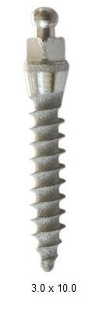 Dental implants With Buttress Threads | SpotImplant