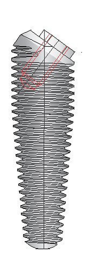 Southern Implants External Hex (Tapered Narrow) Dental Implant ...