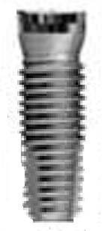 Microtech Minivent plus Dental Implant | SpotImplant