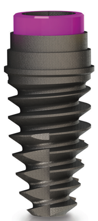 Dental implants With Buttress Threads | SpotImplant