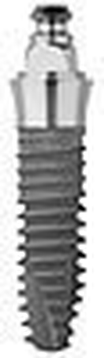 Dentsply Sirona XiVE S (Friadent) Implant dentaire | SpotImplant