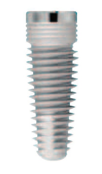 Keystone Dental (Lifecore Biomedical) Stage-1 Dental Implant | SpotImplant