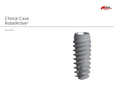 Nobel Biocare NobelActive Dental Implant | SpotImplant