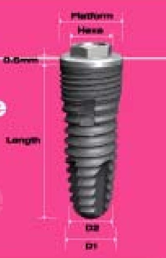 DIO Implant UF Dental Implant | SpotImplant