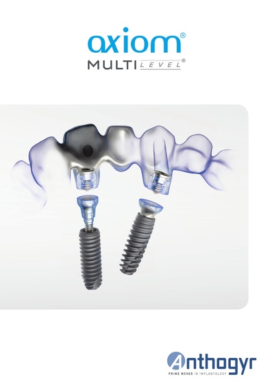 Anthogyr Implants dentaires | SpotImplant
