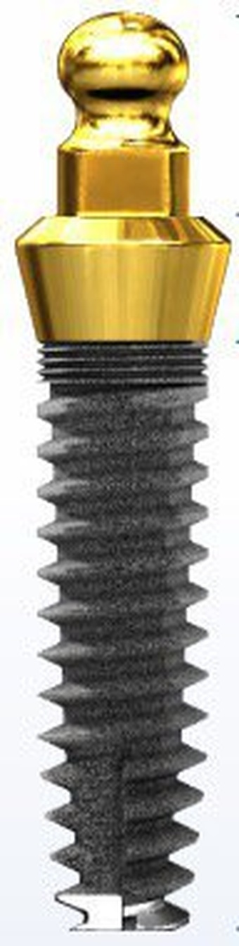 OCO Biomedical Engage Plus Implante dentário | SpotImplant