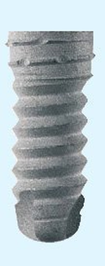 Schütz Dental Impla Dual Surface Hex Dental Implant | SpotImplant