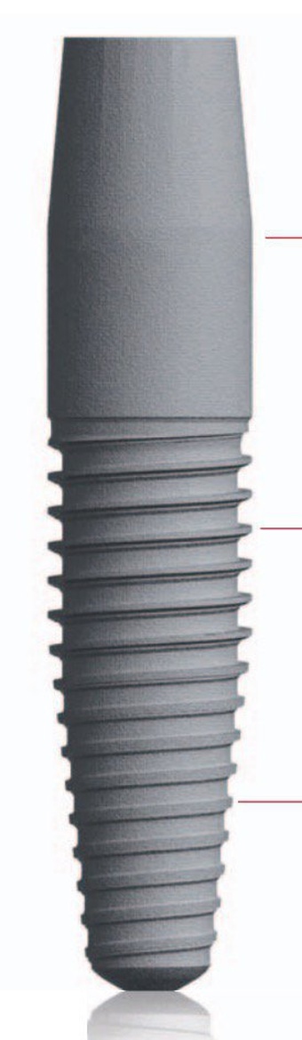 Nobel Biocare Branemark System MK IV Dental Implant | SpotImplant