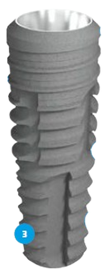 Implance Aggressor Dental Implant | SpotImplant