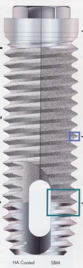 Paragon Dental Implants | SpotImplant