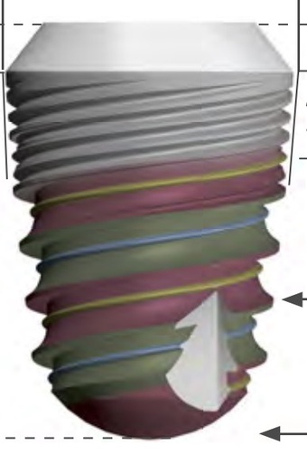 ETK (Euroteknika) Implants dentaires | SpotImplant