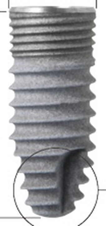 Kyocera Finesia Tissue Level Dental Implant | SpotImplant