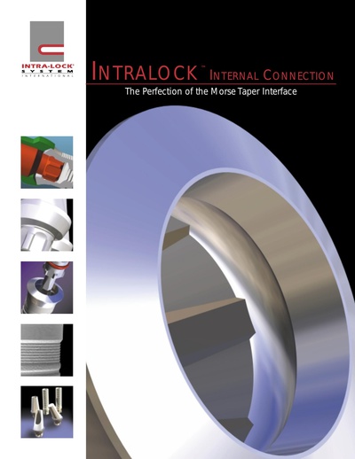 Intra-Lock System International Dental Implants | SpotImplant