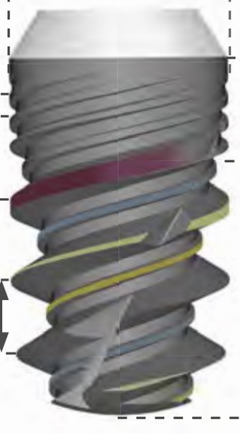 ETK (Euroteknika) Dental Implants | SpotImplant