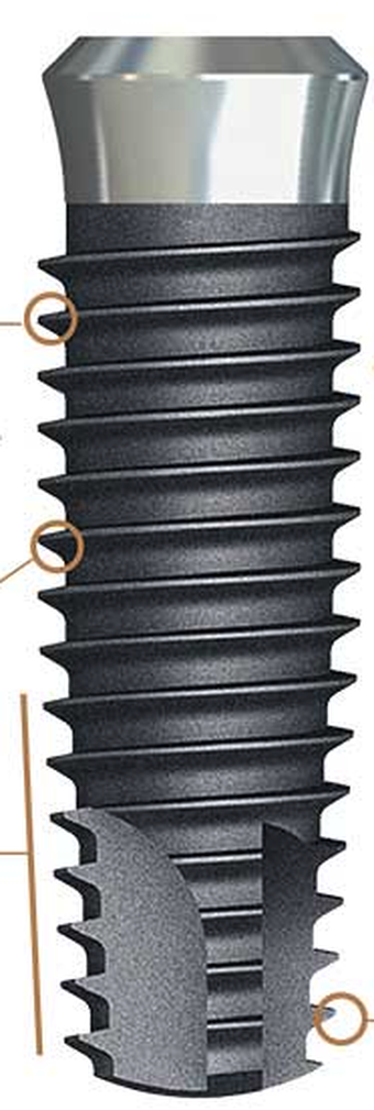 Biotem Dental Implants | SpotImplant