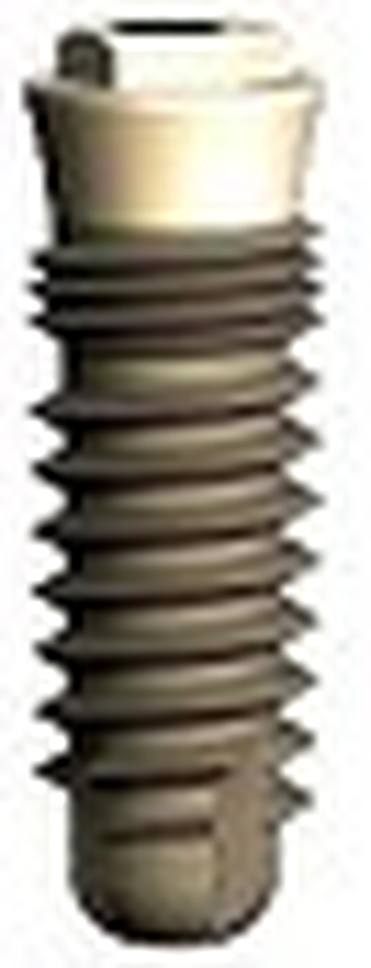 Gi Esse Technology Conus Dental Implant | SpotImplant