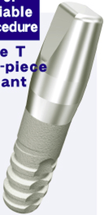 Dental implants With Square Threads | SpotImplant