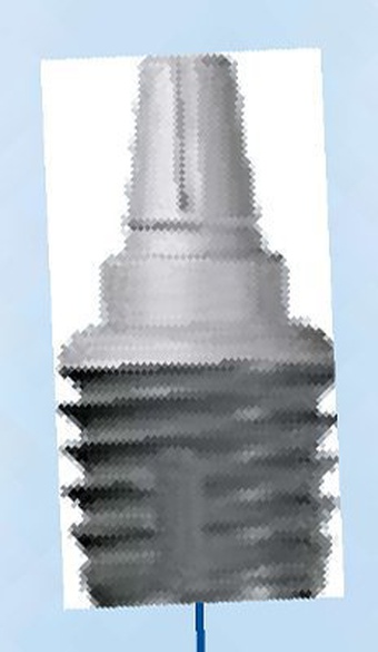 Trinon Titanium QK Dental Implant | SpotImplant