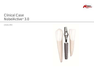 Nobel Biocare NobelActive 3.0 Dental Implant | SpotImplant