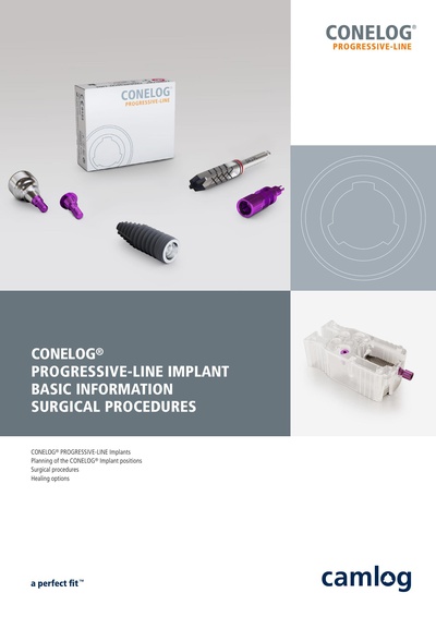 Camlog Conelog Progressive-line Dental Implant | SpotImplant