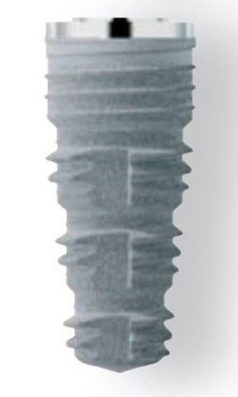 Dentsply Sirona XiVE TG (Friadent) Dental Implant | SpotImplant