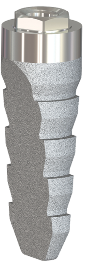 Pec Lab Dental Implants | SpotImplant