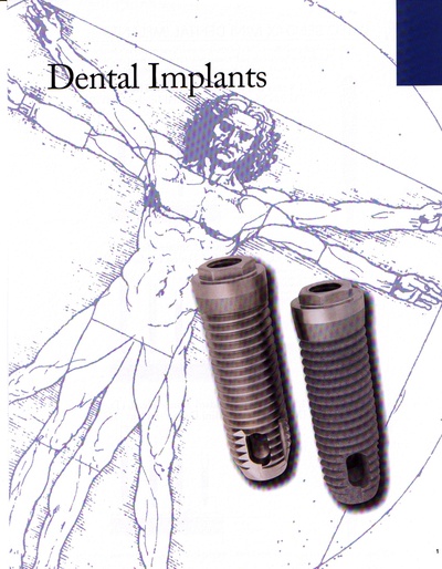IMTEC Mini Fixture Dental Implant | SpotImplant