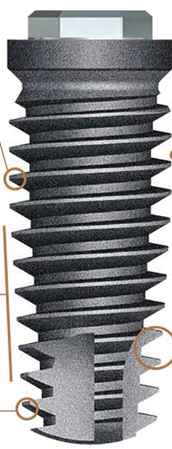 Biotem IR system Dental Implant | SpotImplant