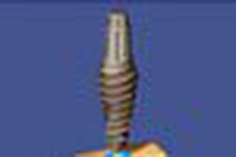 Nobel Biocare NobelReplace CC (Conical Connection) TiUltra Dental ...