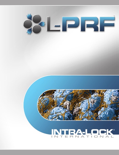 Intra-Lock System International Dental Implants | SpotImplant