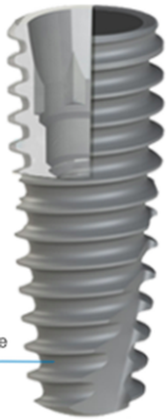 Sigma Implants Sigma Active Dental Implant | SpotImplant