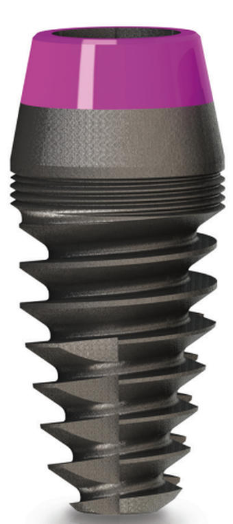 Dental implants With Buttress Threads | SpotImplant